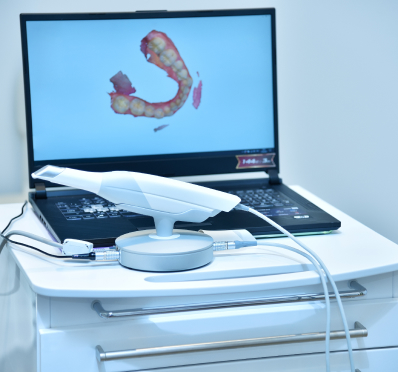 Intraoral Scanner - Montgomery Dental Associates & Implantology Center
